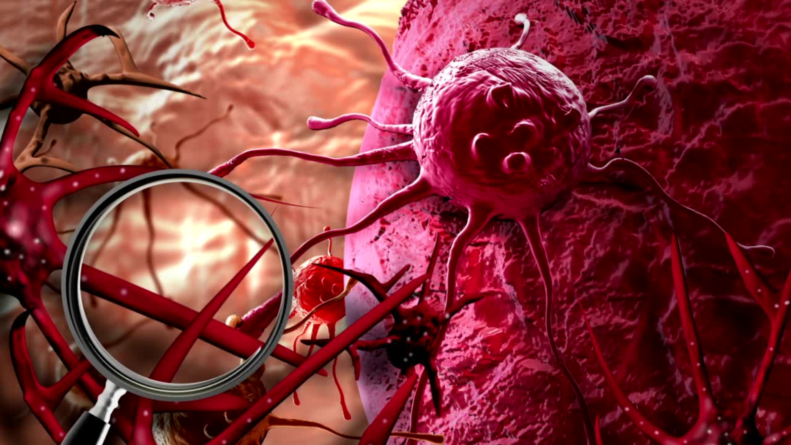 Immunotherapy: A Breakthrough in Modern Cancer Treatment