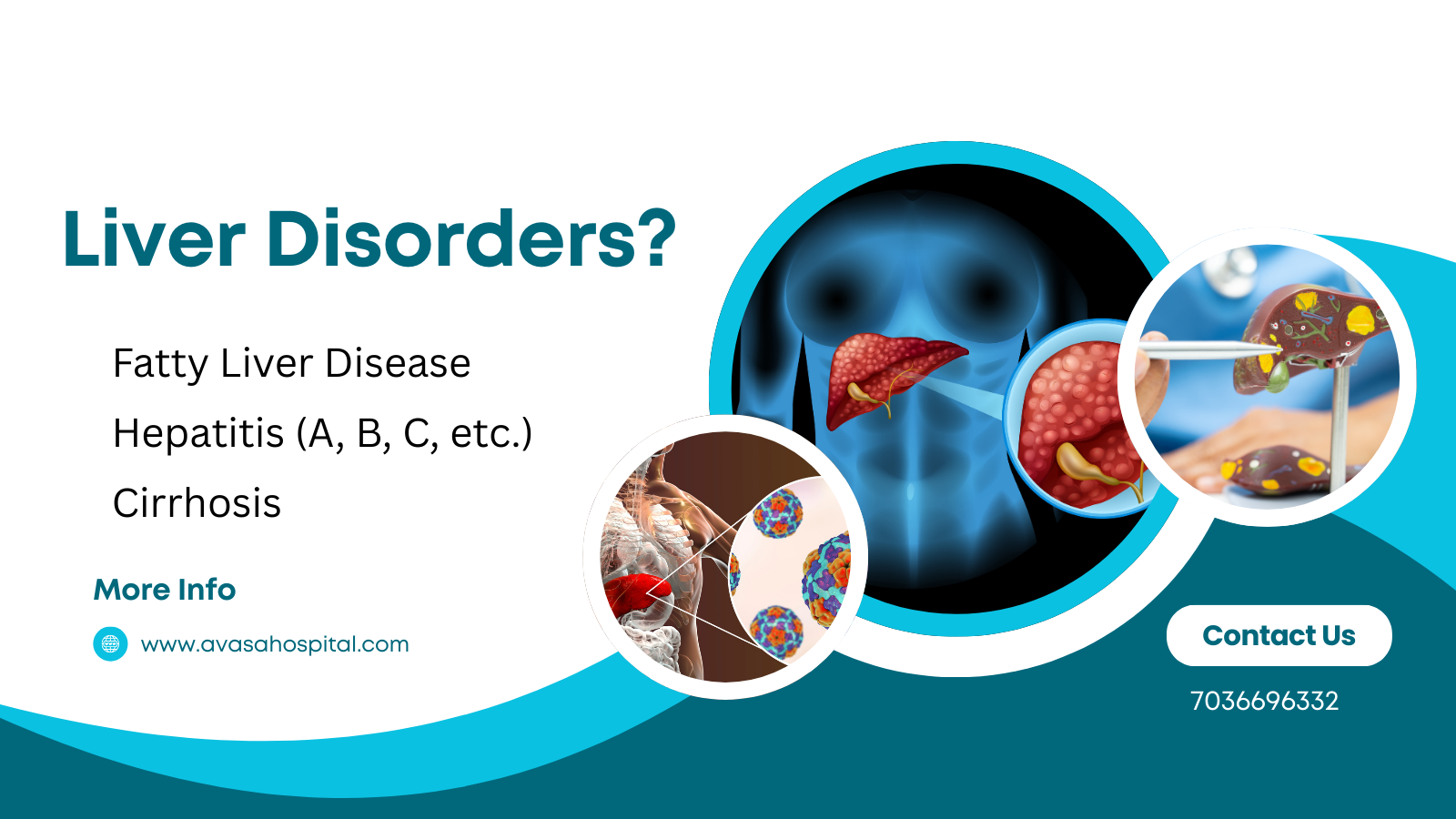Liver Disorders: Fatty Liver, Hepatitis & Cirrhosis Explained
